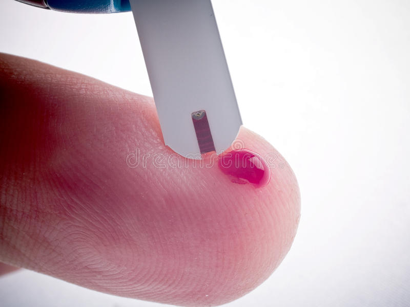 Exactive EQ Glucose Test Strips (50) – Microtec Medical